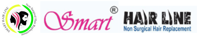 Smart Hairline Clinic | Non-Surgical Hair Replacement & Hair Wigs